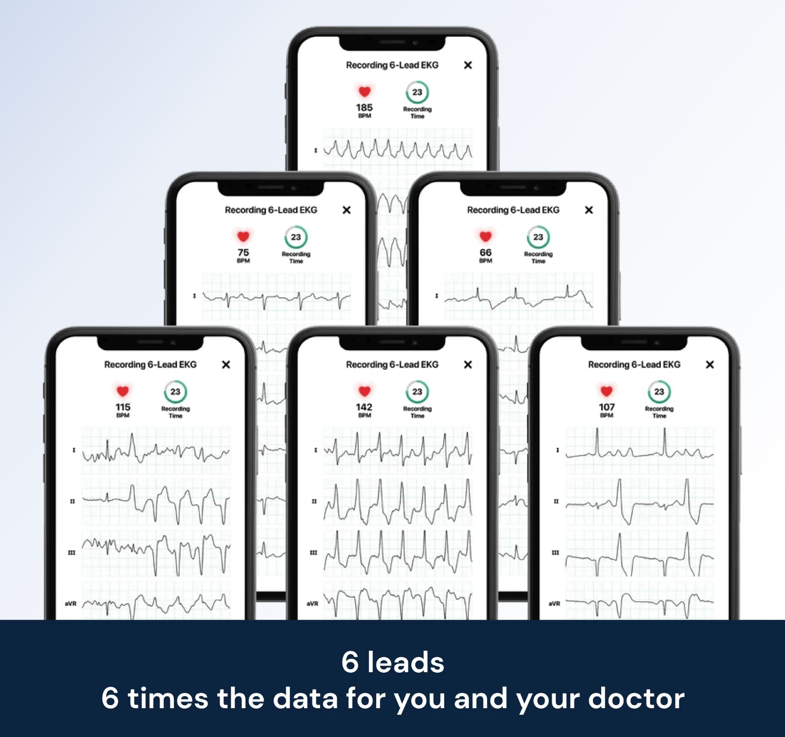 KardiaMobile 6L Review: An Amazing Portable Heart Health Device